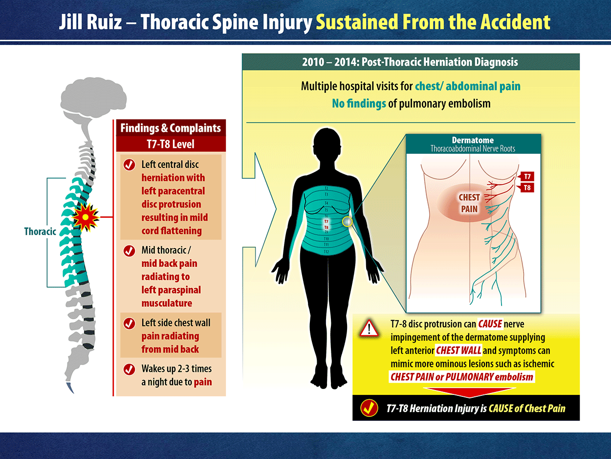 Trial Graphics | TrialSpectrum