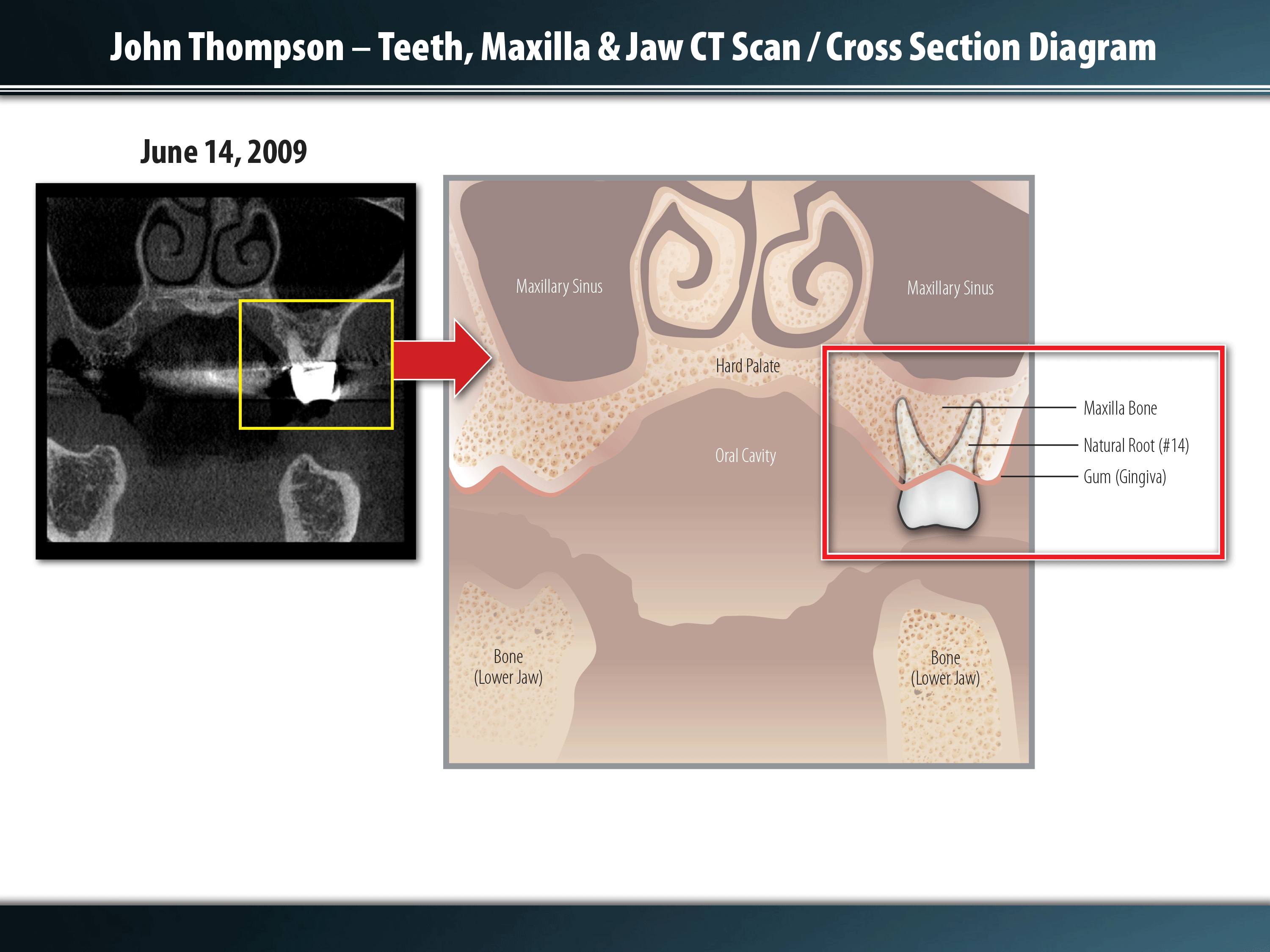 Trial Graphics | TrialSpectrum