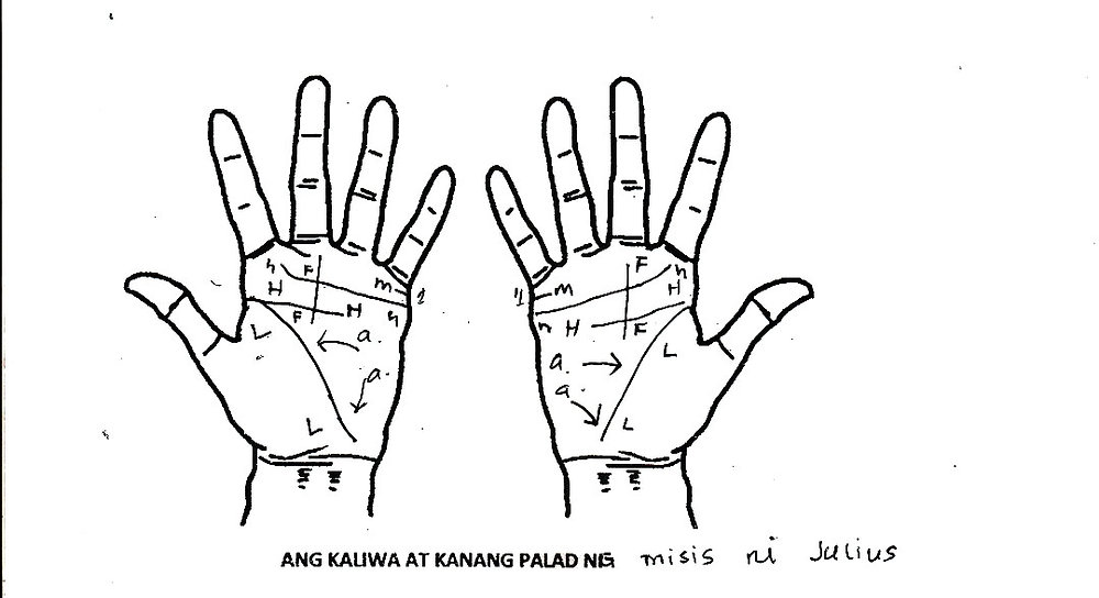 Pagpapaopera, dapat ituloy ng misis na may bukol sa matris dahil hahaba ...