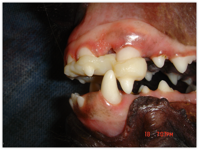 Case: Orthodontic Treatment of a Mandibular Canine Tooth Causing Trauma