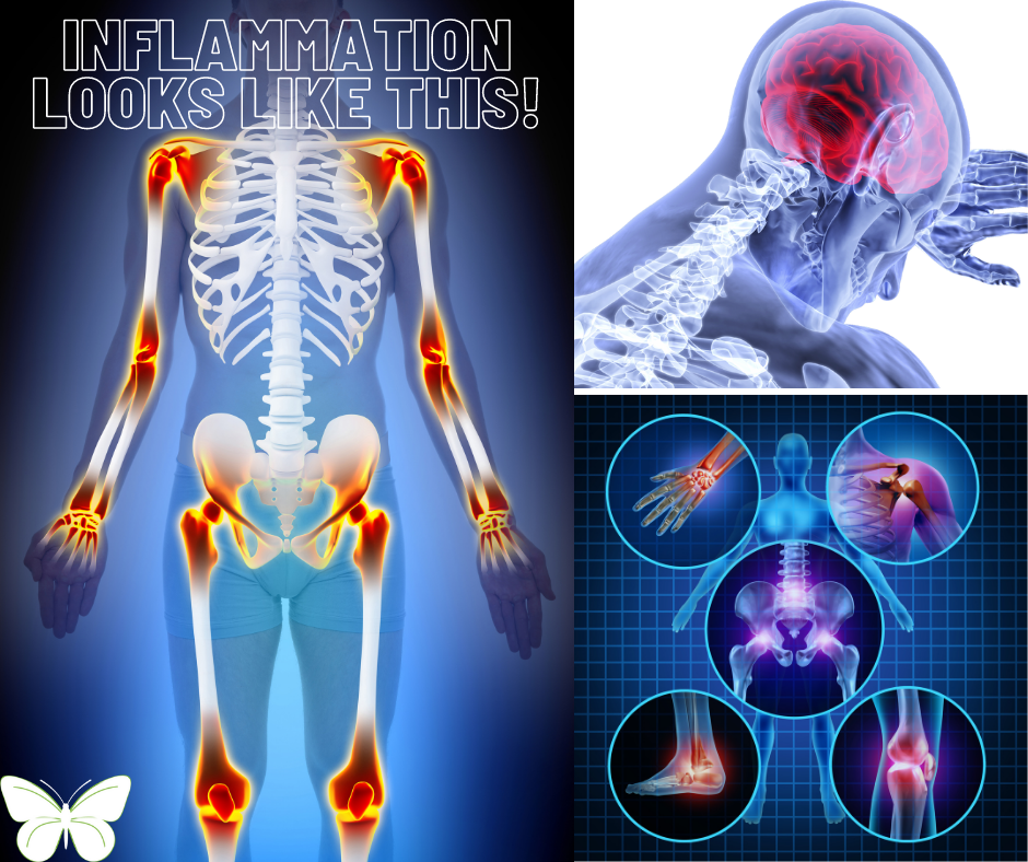 Identifying Inflammation