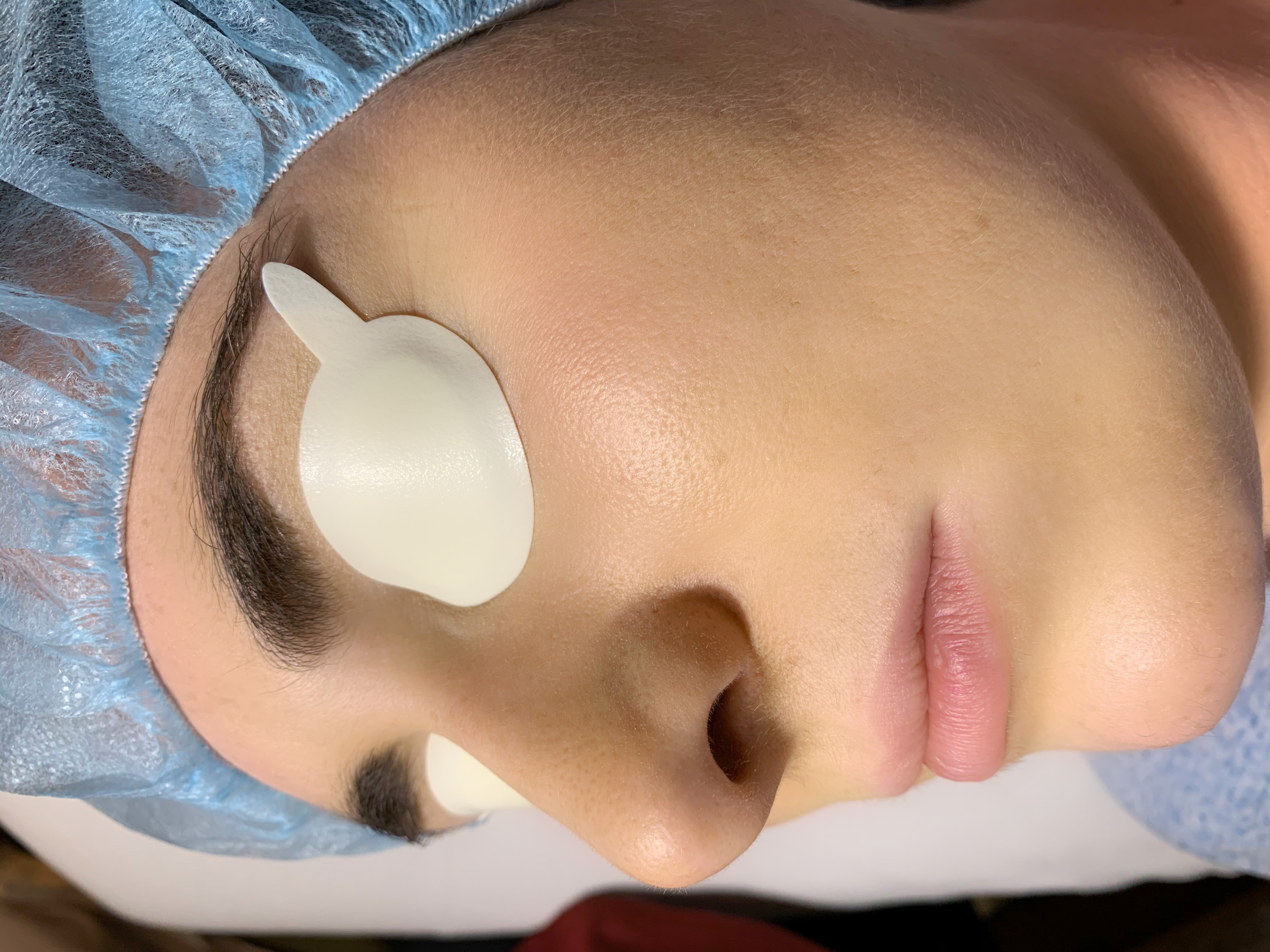 Dermatology Supply | Theia Eye Block | United States