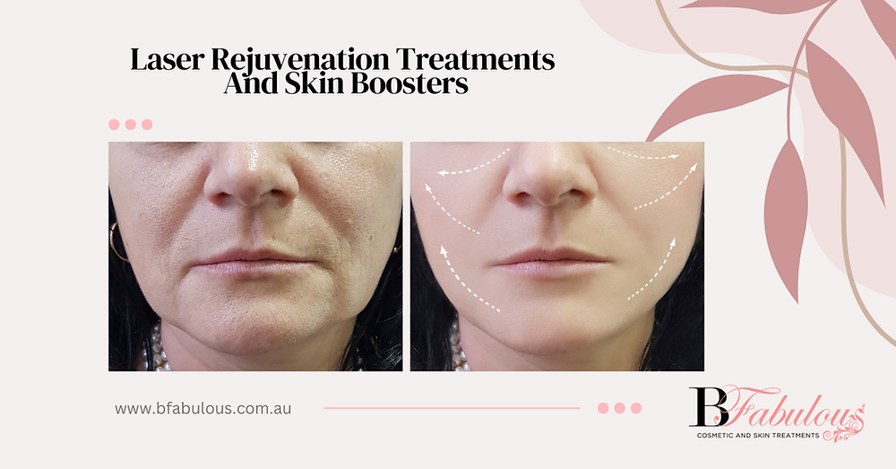 Transform Your Skin with Laser Rejuvenation Treatments
