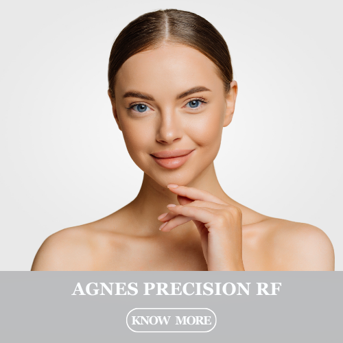 AGNES PRECISION RF