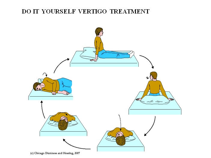 Dizziness (Including Vertigo)