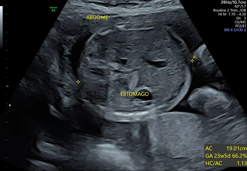Tabelas e percentis da Circunferência Abdominal Fetal | Ei, Doc!