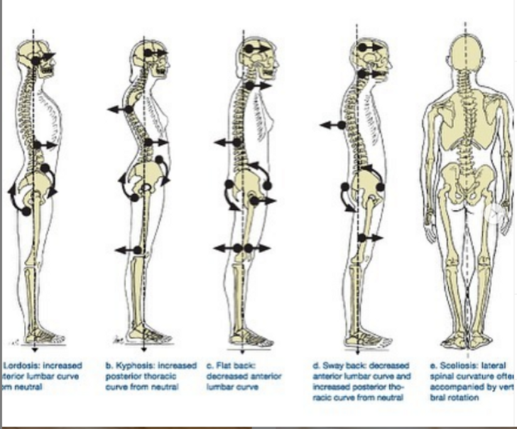 The Importance of Posture