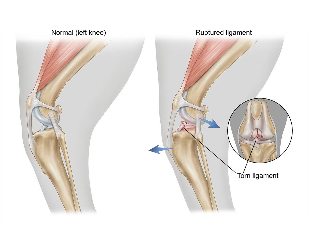 Torn Cranial Cruciate Ligament (CCL) in Dogs: Treatment and Recovery Guide