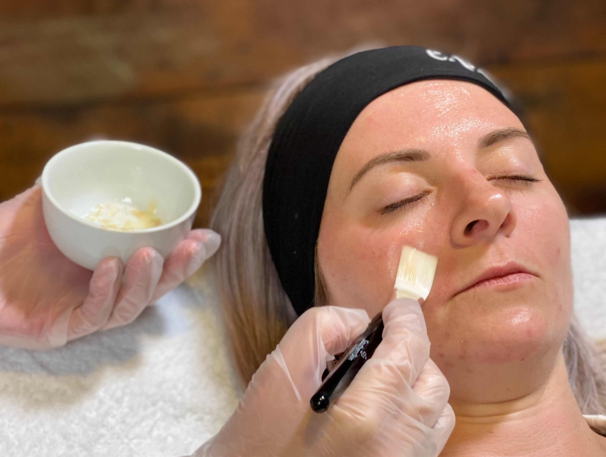 Chemical Peels & Advanced Facial Peels Nelson | Luminous Skin