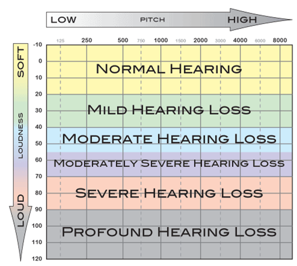 Audiogram Interpretation 101 Audiogram Interpretation 101