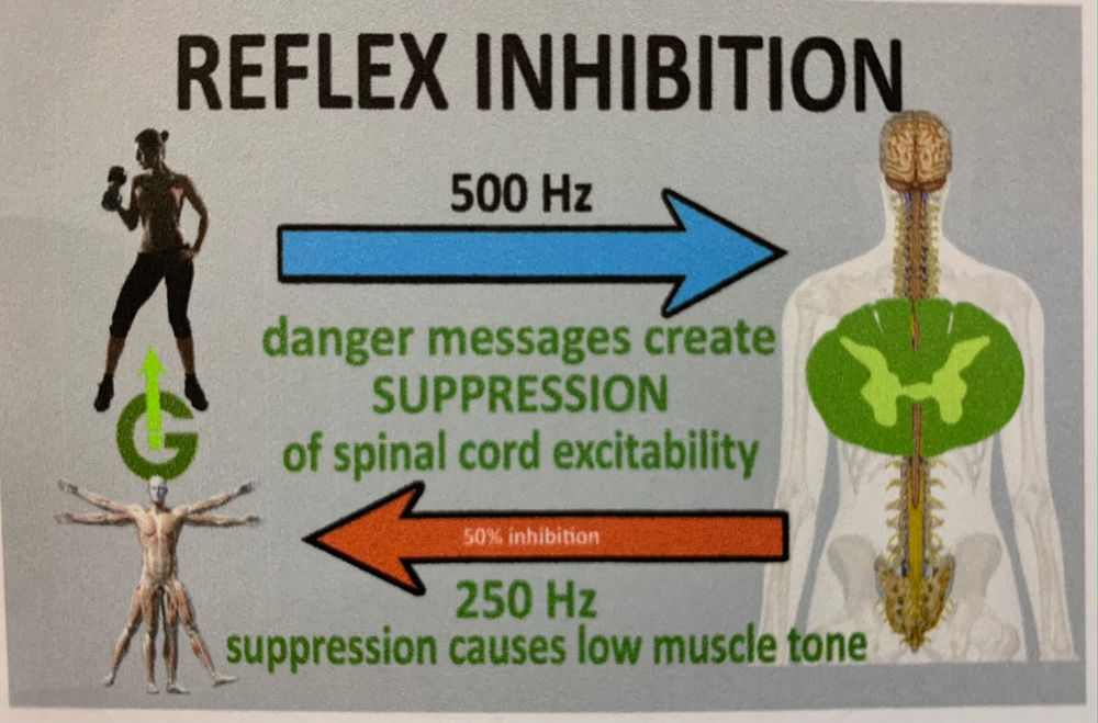 Are You in Pain because of Muscle Inhibition?