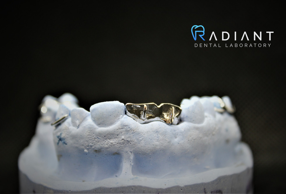 PARTIAL DENTURES | Radiant