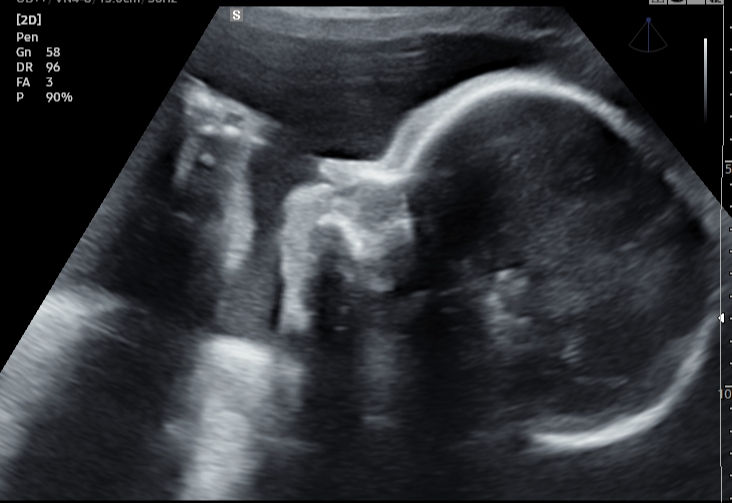 2D ULTRASOUND | Oh My Baby!