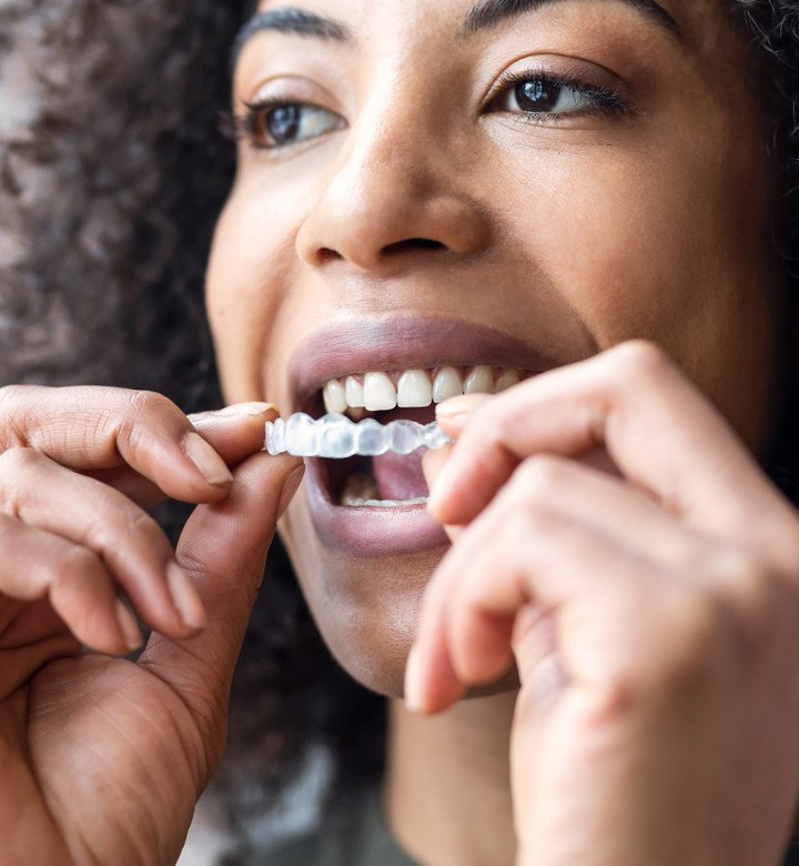 Invisible Dental Appliances, The Rise of Discreet Options