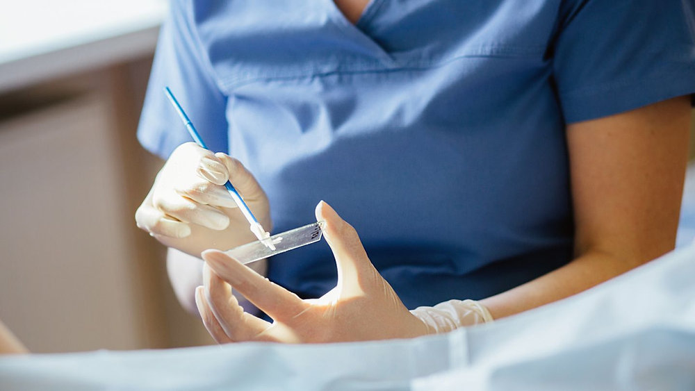 Smear Testi Nedir?