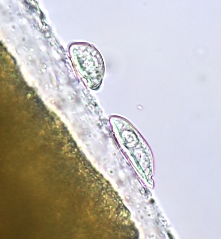 Meet the Soil Food Web
