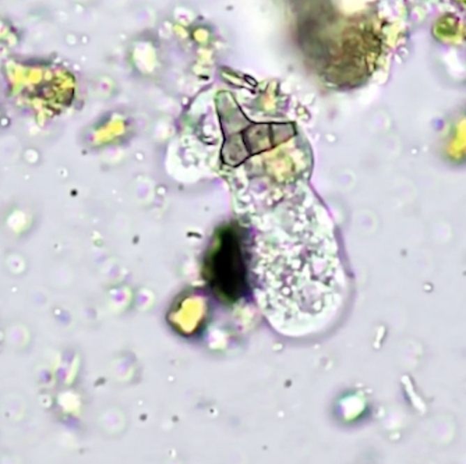 Meet the Soil Food Web