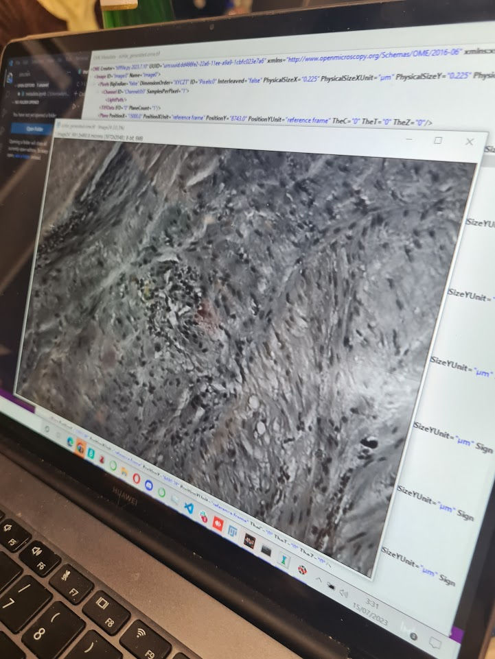 Erickson LAB goes GOSH Hackathon - Developing the prototype HistoScanner