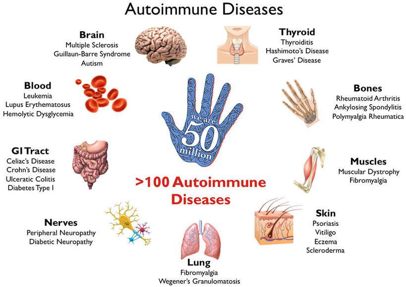 The Autoimmune Spectrum: Does It Exist, and Are You on It?