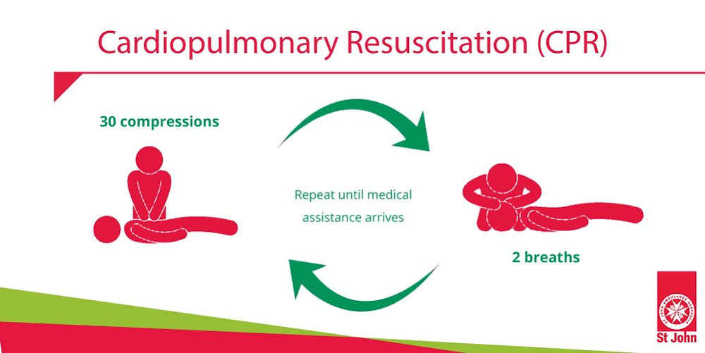 CPR Steps – It’s As Easy As 1 – 2 – 3