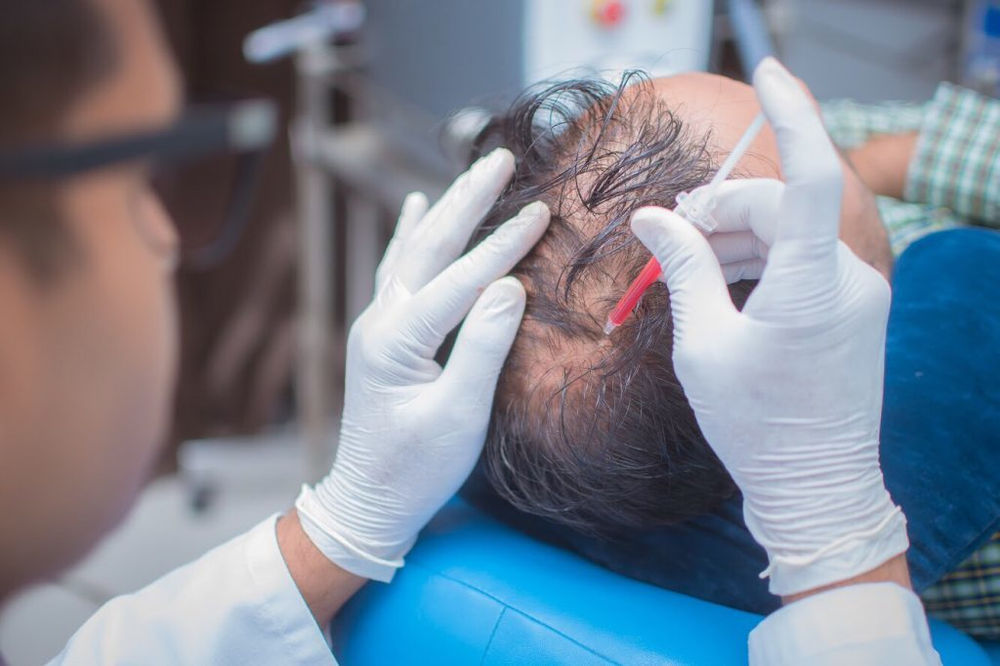 5 pasos esenciales para elegir la clínica de pérdida de cabello adecuada