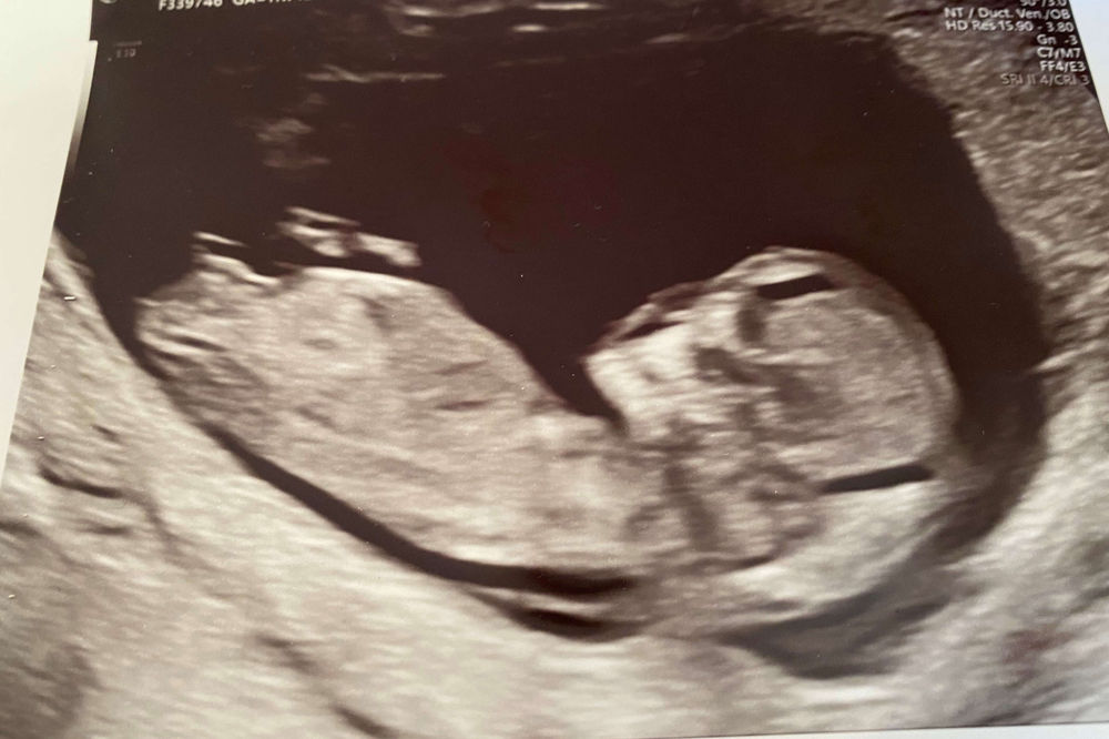 Food and body image during the first trimester of pregnancy