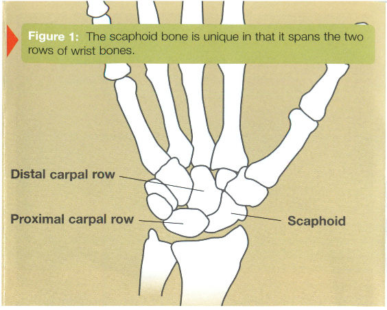 Scaphoid Fractures