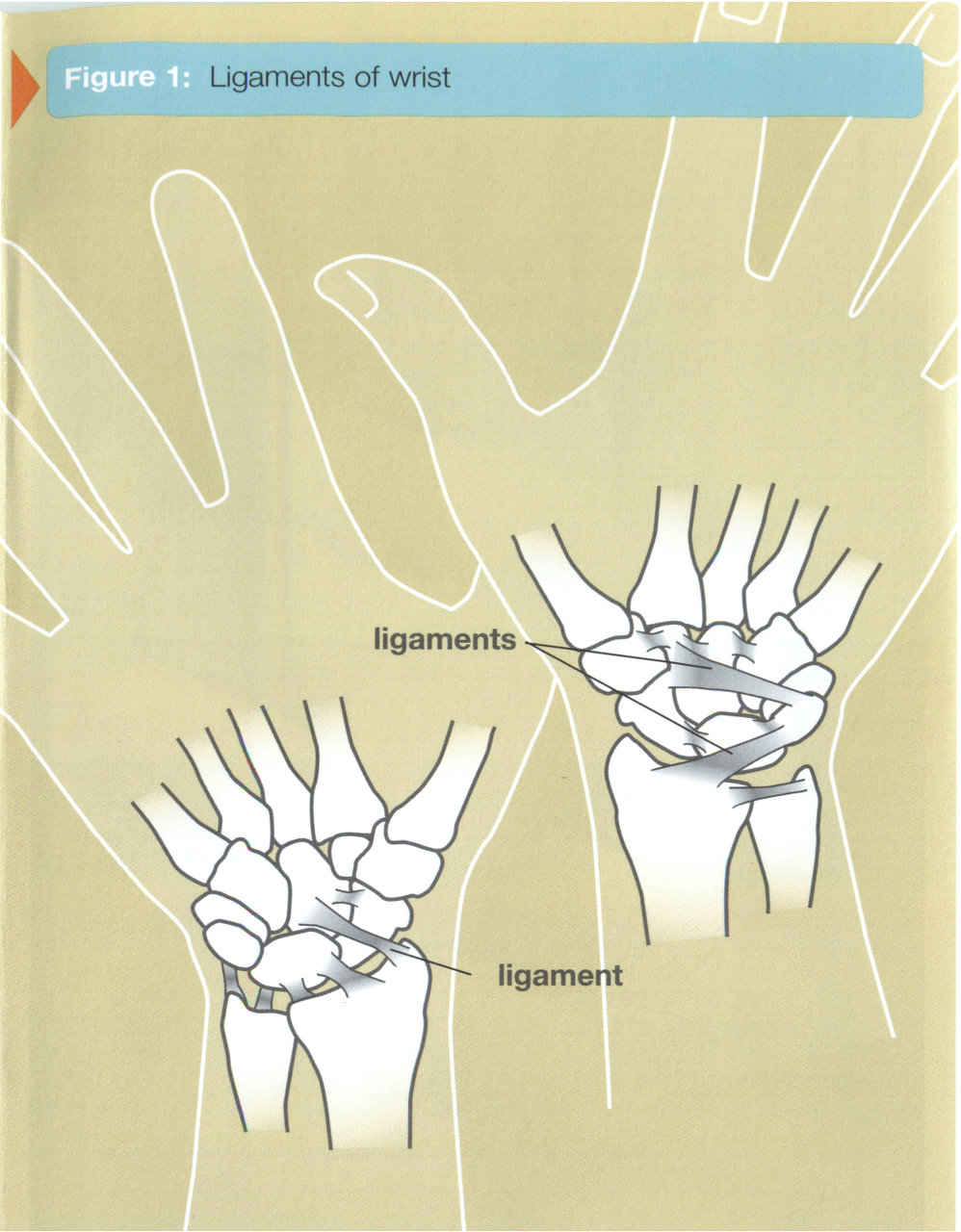 Wrist Sprains | Austin Hand Group | Dr. Ira Lown, MD | Hand Surgery Austin