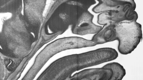 Examples of High Resolution Episcopic Microscopy (HREM) | Indigo Scientific