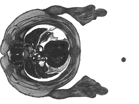 High-Resolution Episcopic Microscopy (Optical HREM): Imaging System for ...