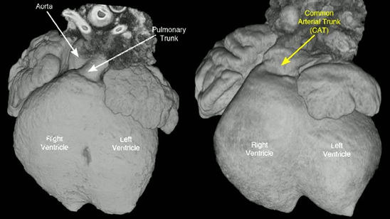 Examples of High Resolution Episcopic Microscopy (HREM) | Indigo Scientific