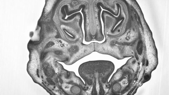 Examples of High Resolution Episcopic Microscopy (HREM) | Indigo Scientific