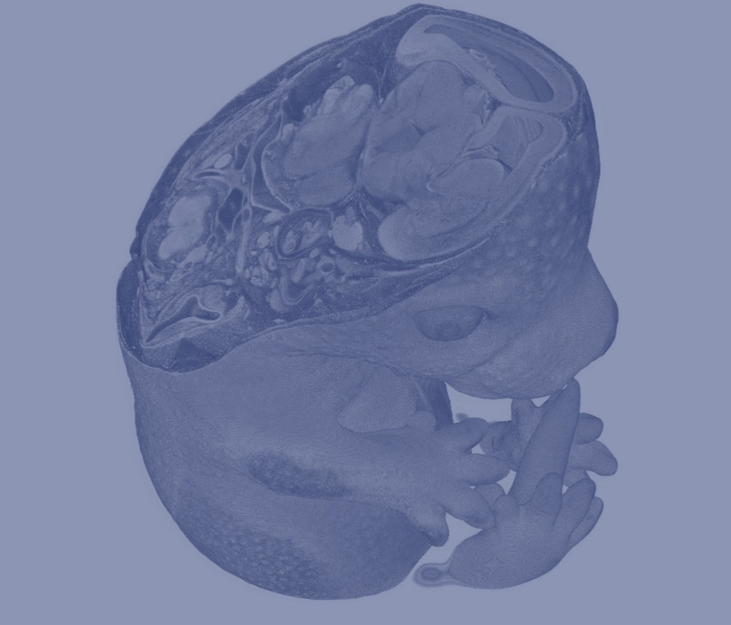 High-Resolution Episcopic Microscopy (Optical HREM): Imaging System for ...