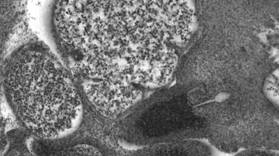 Examples of High Resolution Episcopic Microscopy (HREM) | Indigo Scientific