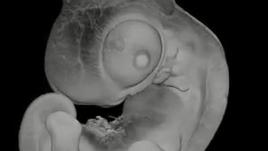 Examples of High Resolution Episcopic Microscopy (HREM) | Indigo Scientific