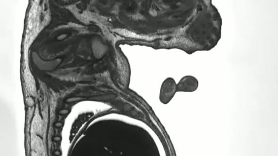 Examples of High Resolution Episcopic Microscopy (HREM) | Indigo Scientific