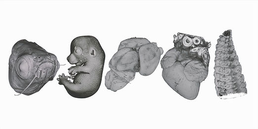 High-Resolution Episcopic Microscopy (Optical HREM): Imaging System for ...