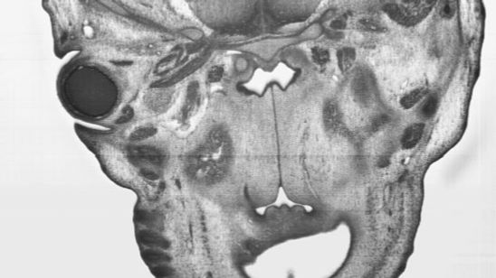 Examples of High Resolution Episcopic Microscopy (HREM) | Indigo Scientific
