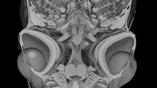 Examples of High Resolution Episcopic Microscopy (HREM) | Indigo Scientific