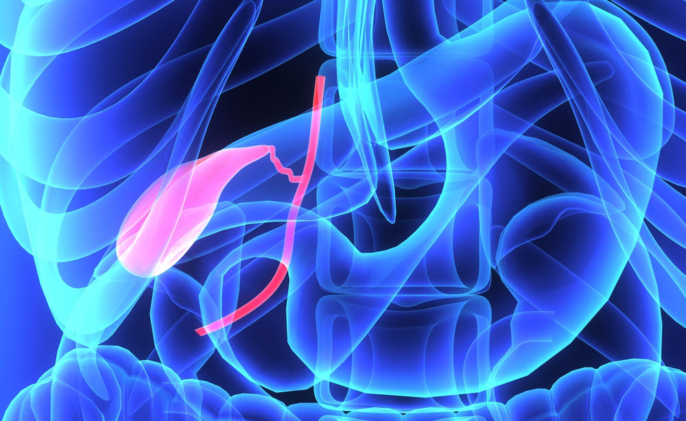 Calcoli alla cistifellea: ne parliamo con il dr. Coviello