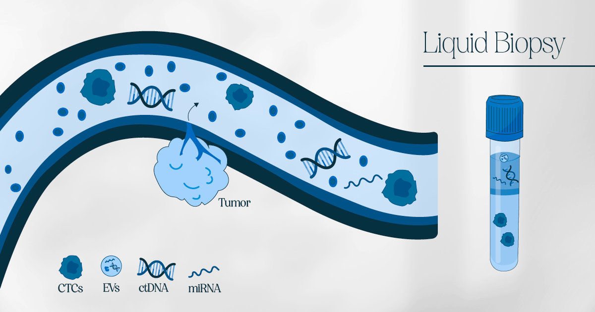 A new tool to diagnose: liquid biopsies | Scientia News