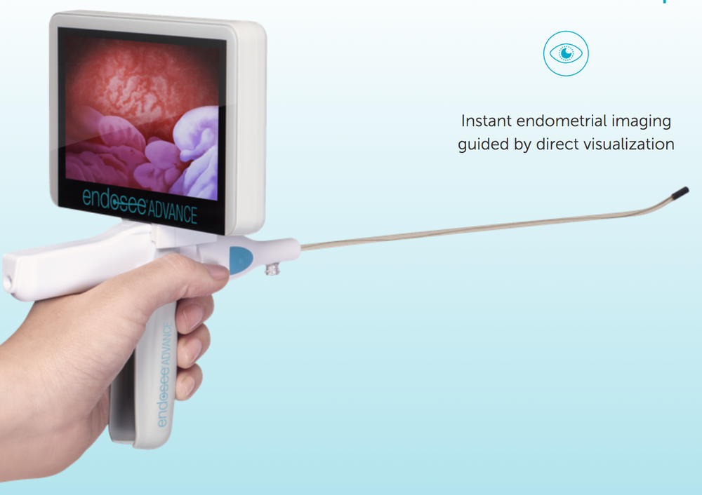 Office Hysteroscopy with EndoSee