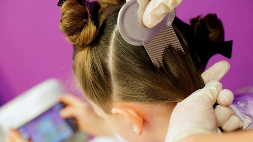 Complete Guide: How to Remove Head Lice Step by Step