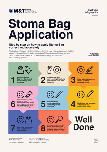 Stoma Bag Application - Step by step | M&T Network