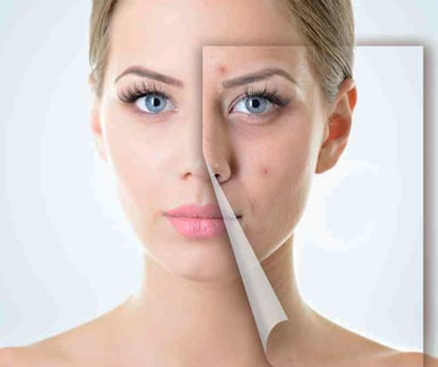 Services | Skin Aesthetics Dermal Clinic