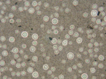 Cryptococcus neoformans | micoclinicaufcspa