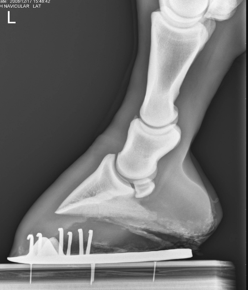 Delayed Patellar Release