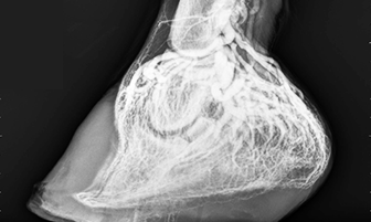 What We Know and What We’re Learning about Laminitis