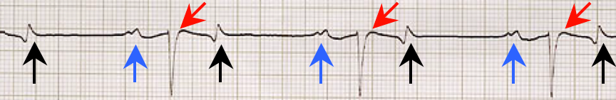 The Equine Heart (Part 2): Common Cardiac Disease