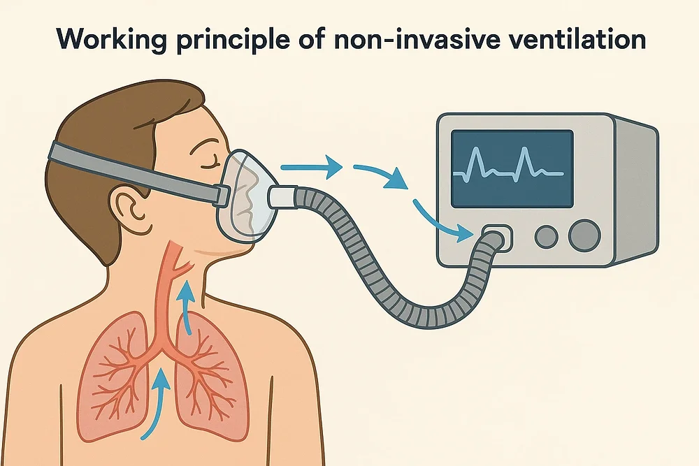 Non-Invasive Ventilation (NIV): What It Is, Types, Benefits & Uses